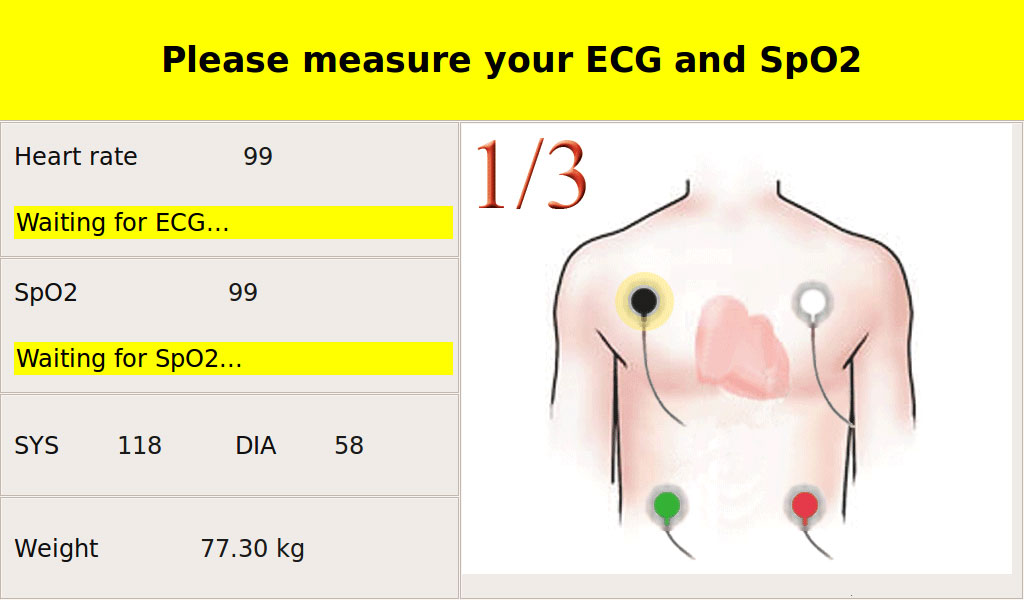 5_ecg_request - AAL Programme
